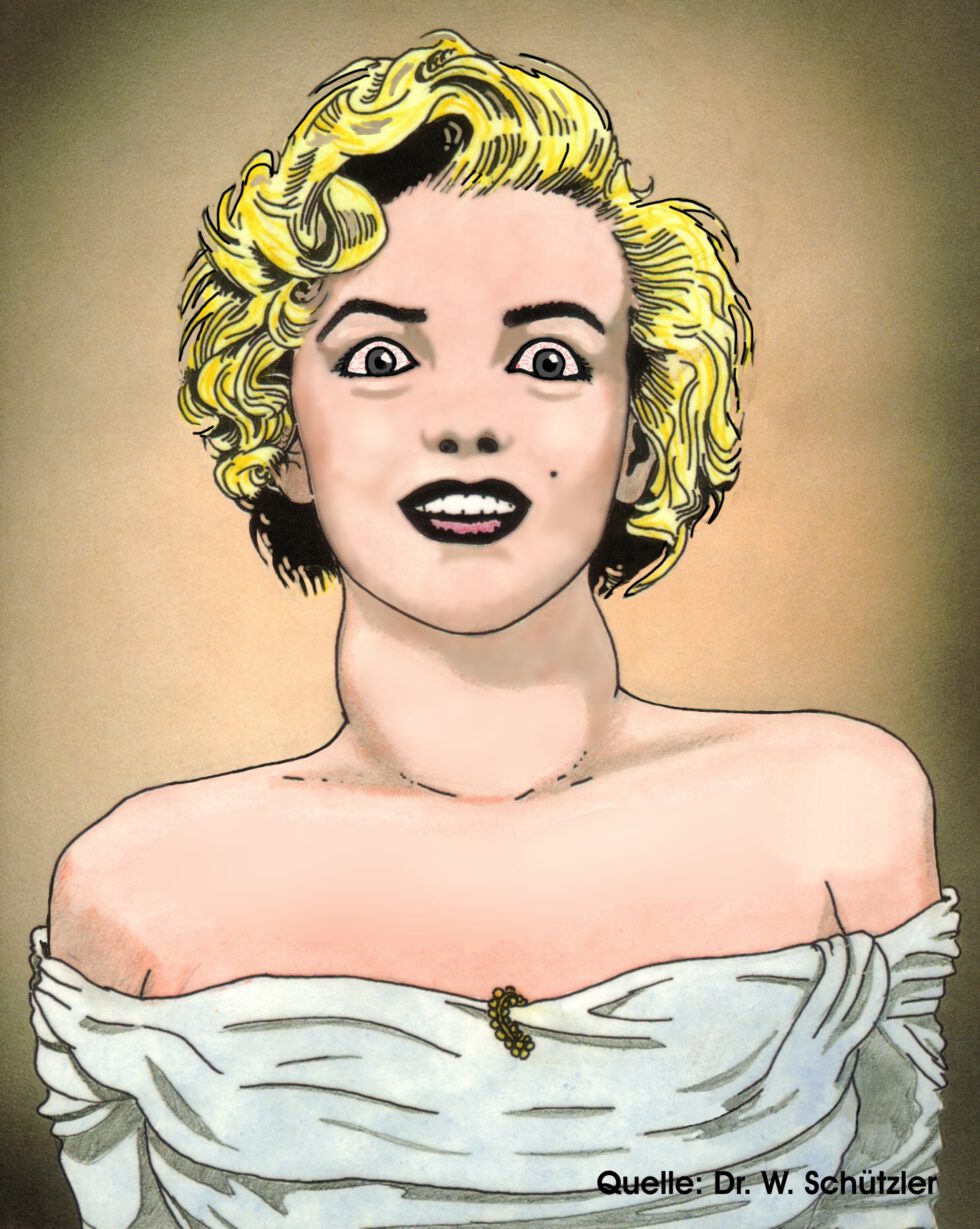 Morbus Basedow | Dr. Schützler - Schilddruese online